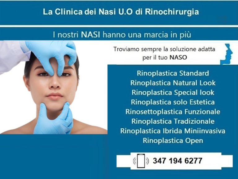 RINOPLASTICA : LA CORREZIONE DEL NASO GRECO – Dott. Carmine Martino ...